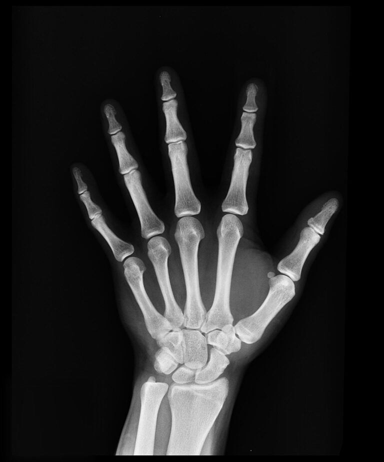 Does Urgent Care Do X-Rays? Get the Facts Now